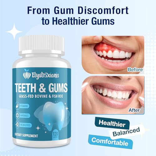Vitamins to strengthen gum tissue