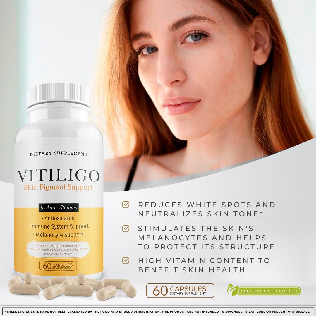 vitiligo capsules for brighter skin