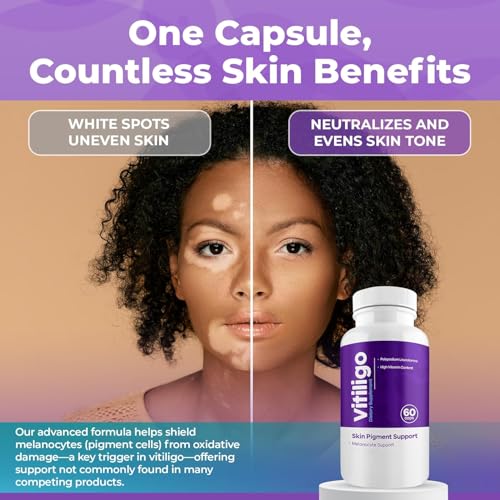 vitiligo capsules for natural skin care