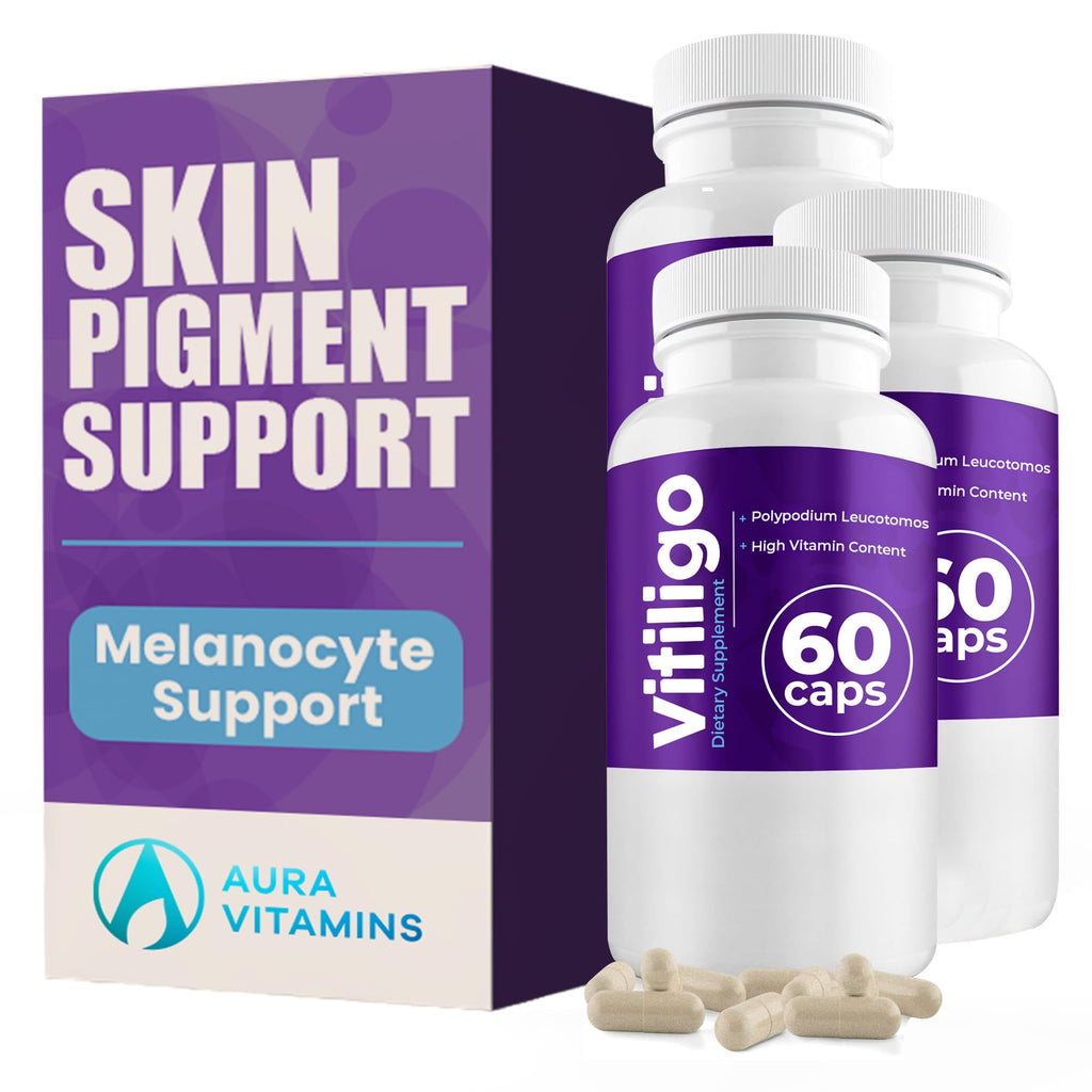 vitiligo capsules for skin health