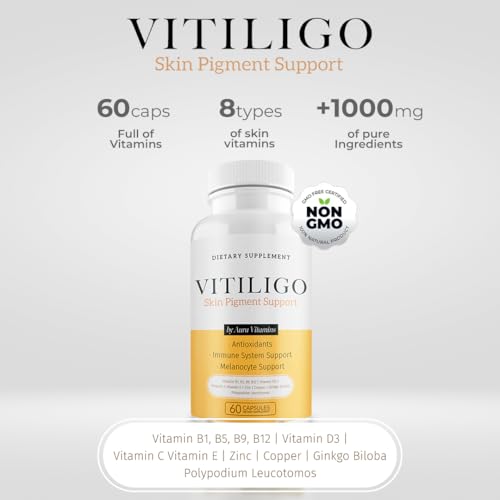 vitiligo capsules promote even skin tone