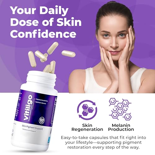 vitiligo capsules support skin health