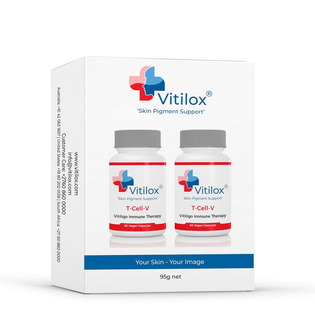 Vitiligo treatment immune therapy