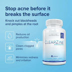 whole food multivitamin for acne