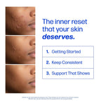 Zinc gluconate for clear complexion