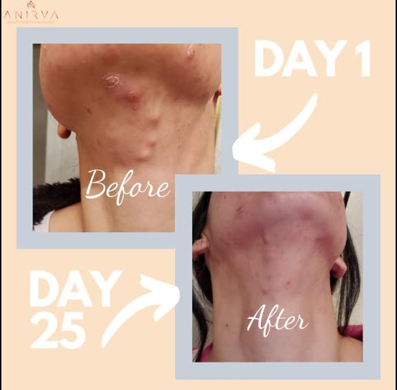 Zinc vitamins for skin clarity